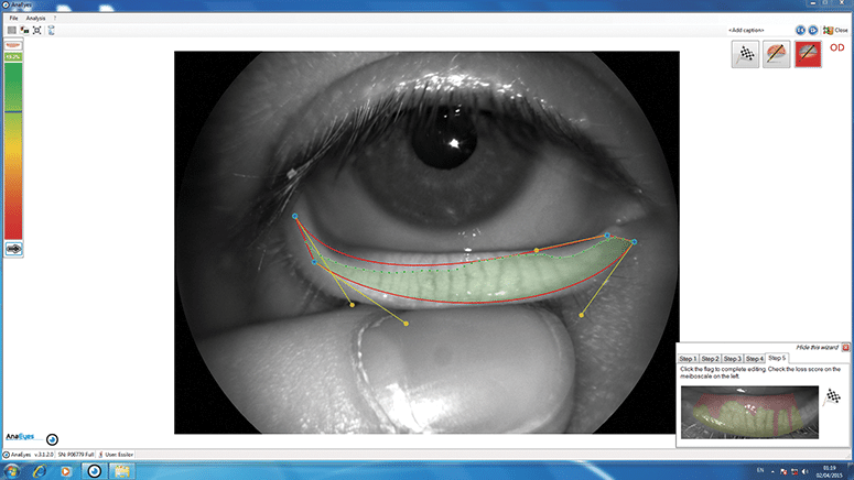 Cornea 550 - Essilor Instruments USA