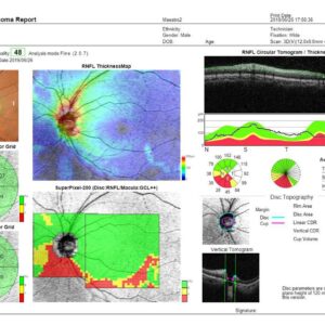 OCT500 Advanced Robotic OCT - Essilor Instruments USA